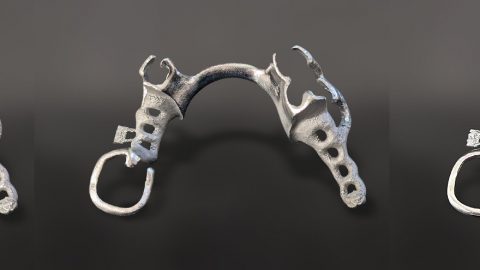 i-PD RPD Frame - i-PRODENS