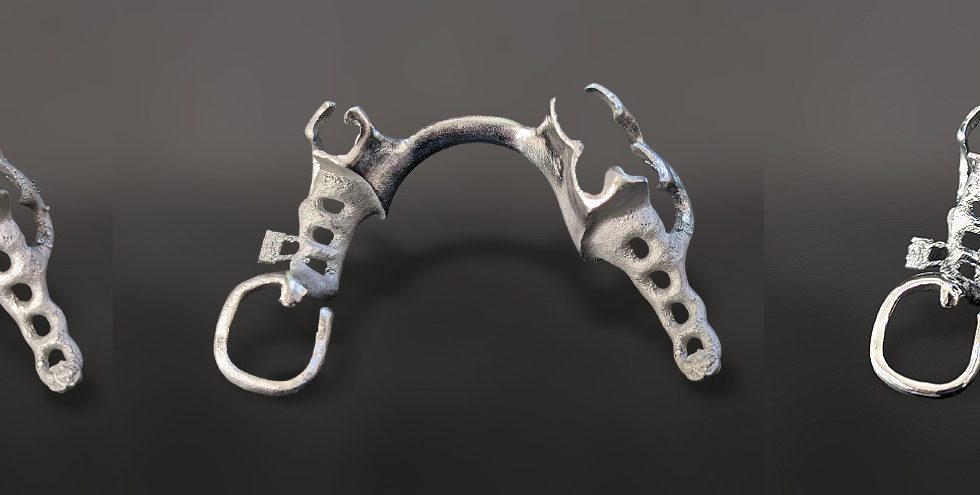 i-PD RPD Frame - i-PRODENS