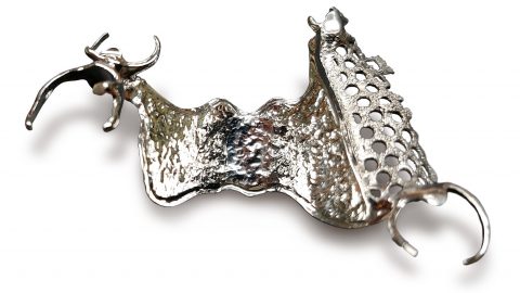 i-PD RPD Frame - i-PRODENS